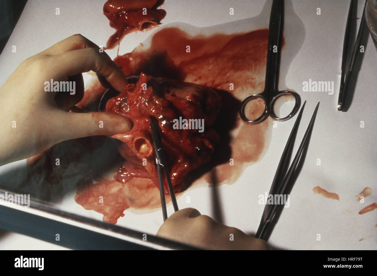 Heart dissection Banque de photographies et d’images à haute résolution ...