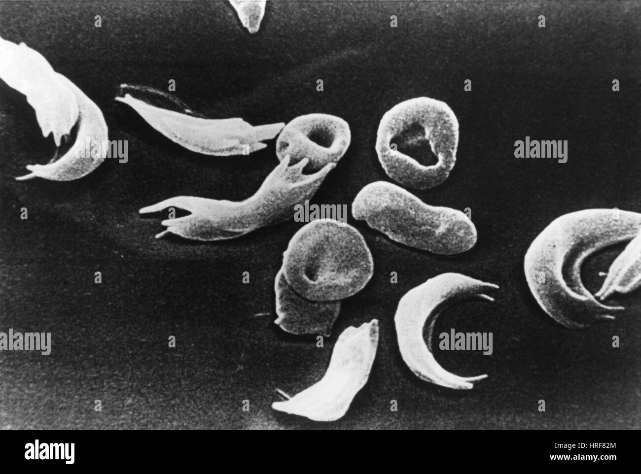 Sickle cell Banque d'images noir et blanc - Alamy