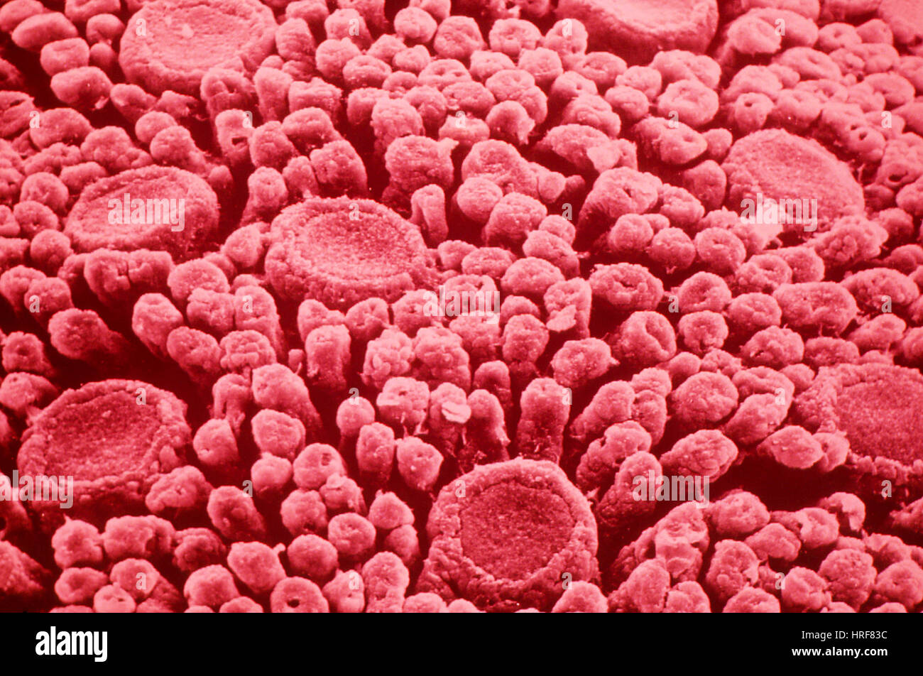 Papille Filiforme Banque d'image et photos - Alamy