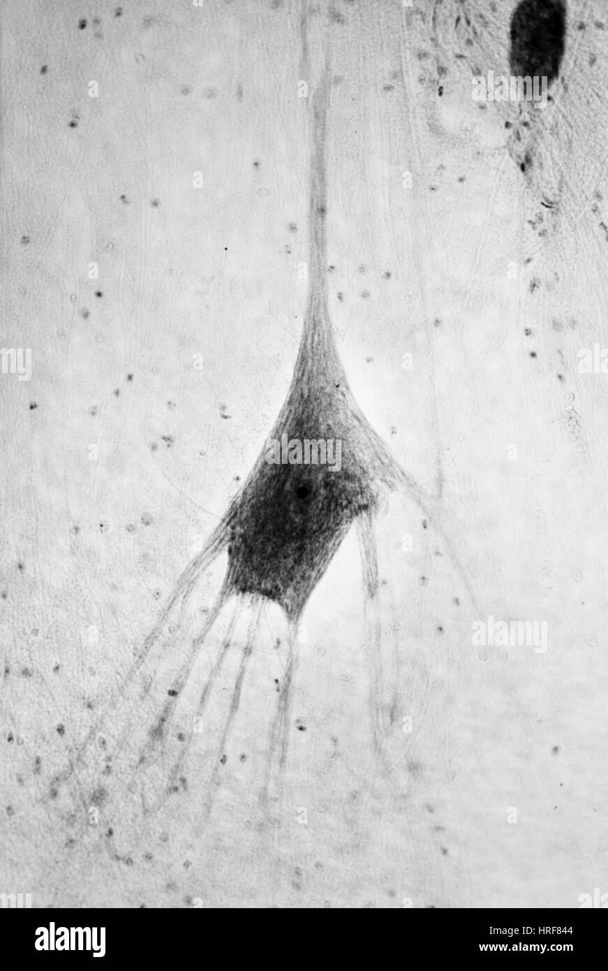 Neuron micrograph Banque de photographies et d’images à haute ...
