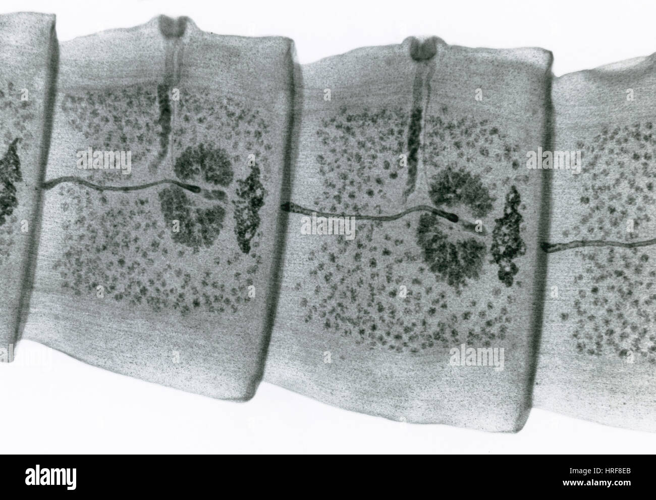 Taenia sp Banque de photographies et d’images à haute résolution - Alamy