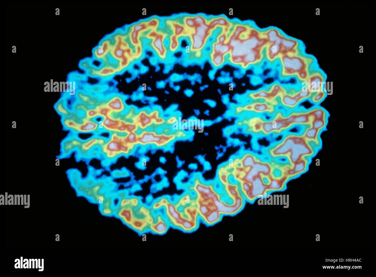 Métabolisme du glucose Banque de photographies et d’images à haute ...