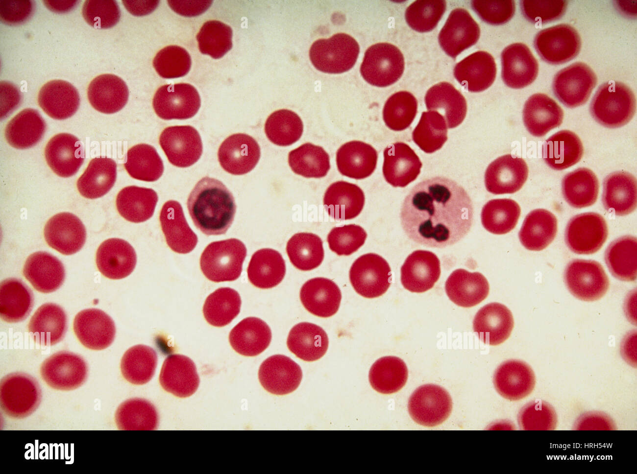 Light micrograph red blood cells Banque de photographies et d’images à ...