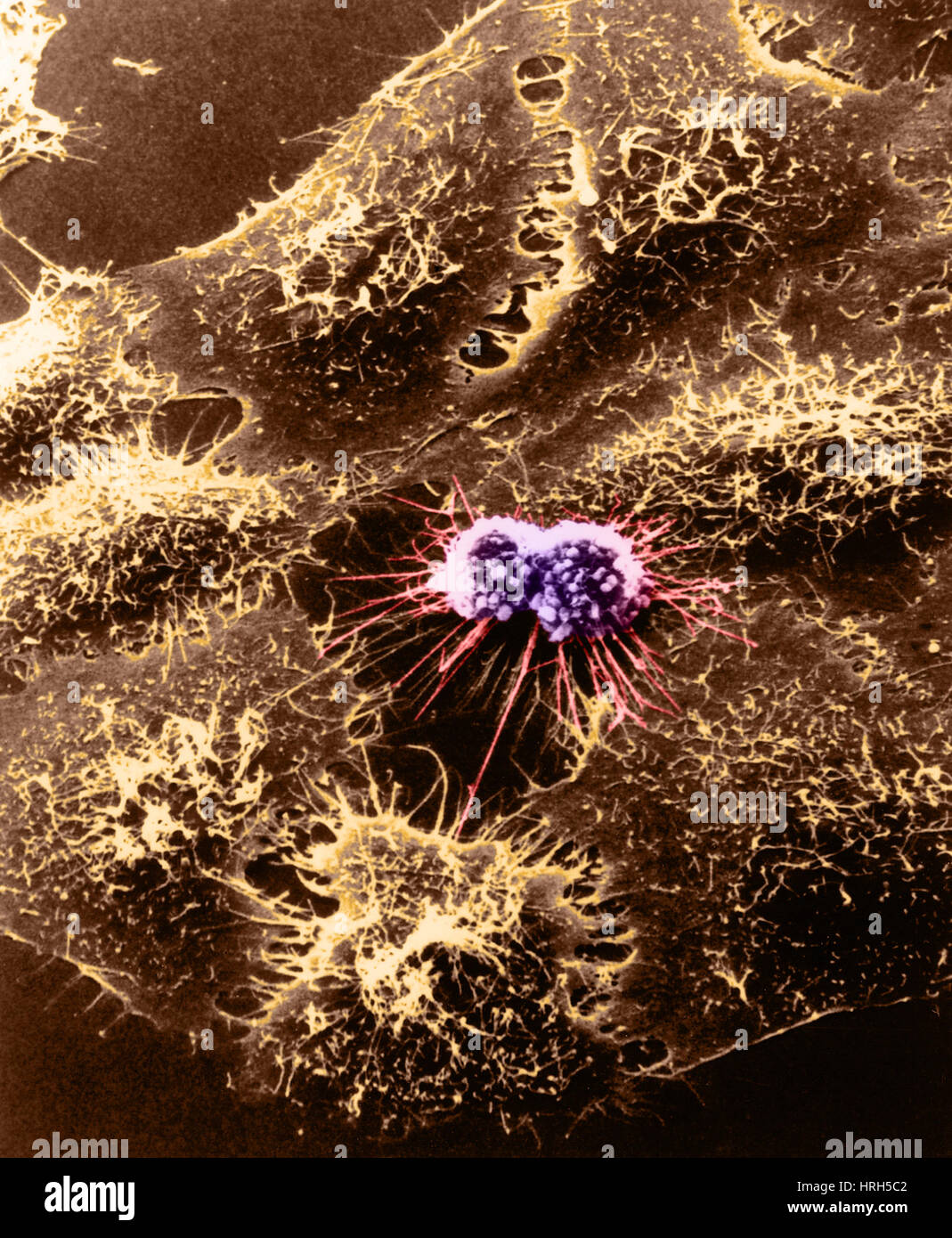 Hela Cell Banque d'image et photos - Alamy