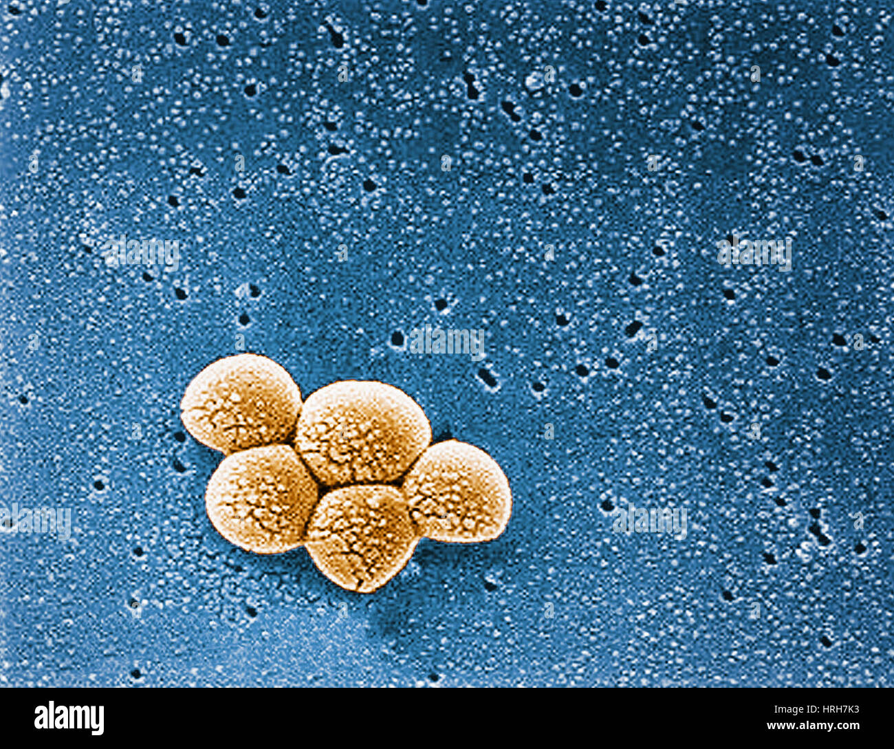 Staphylocoque doré image Banque de photographies et d’images à haute ...