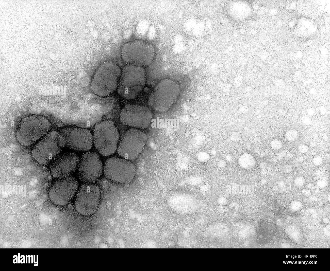 Virus de la variole majeure Banque d'images noir et blanc - Alamy