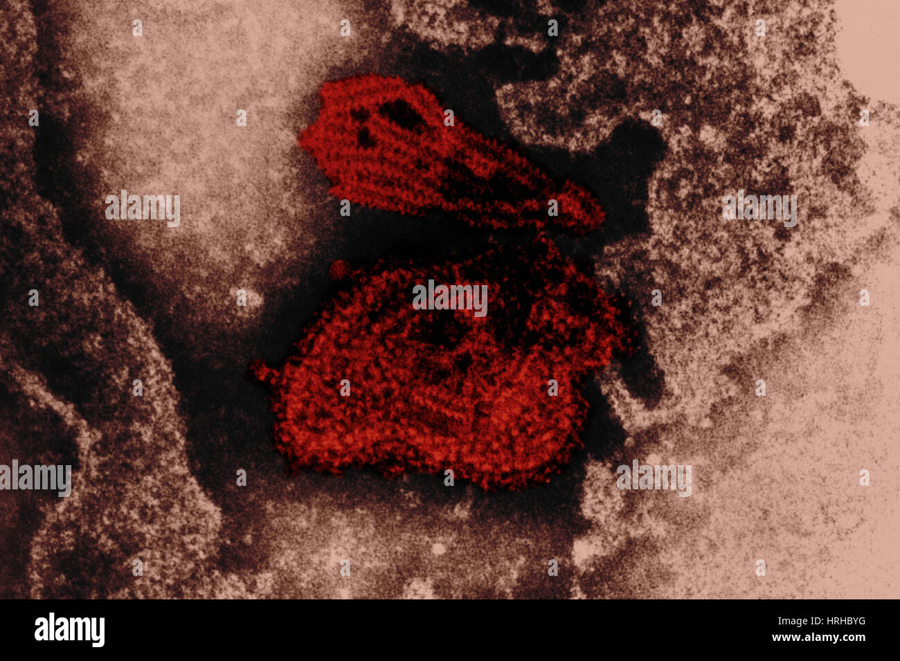 Parotidite des oreillons Banque de photographies et d’images à haute ...