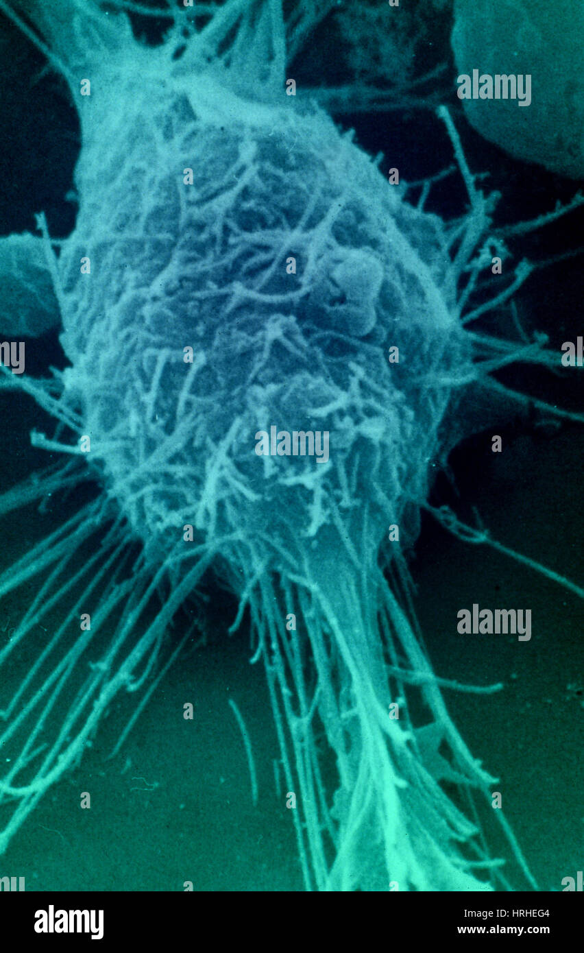 Cellules de neuroblastome Banque de photographies et d’images à haute ...