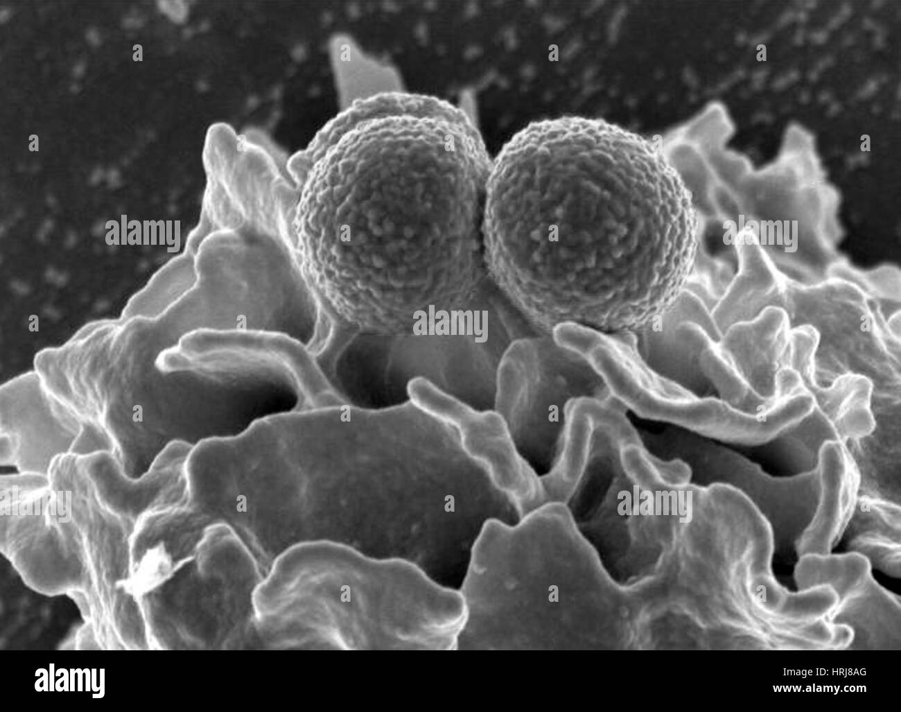 Staphylococcus aureus, le SARM, SEM Photo Stock - Alamy