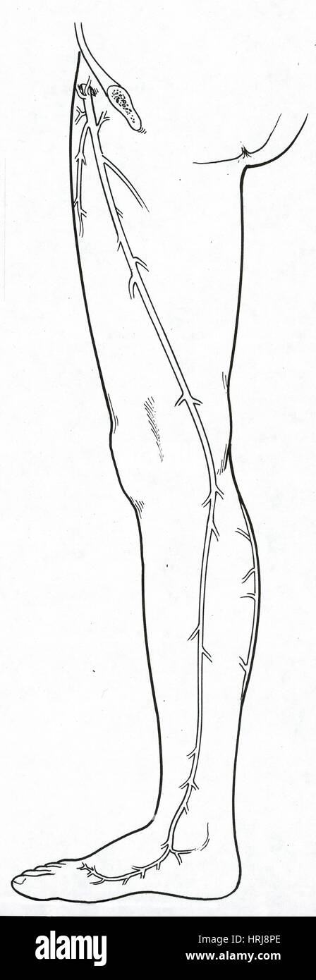 Grande veine saphene Banque de photographies et d’images à haute ...