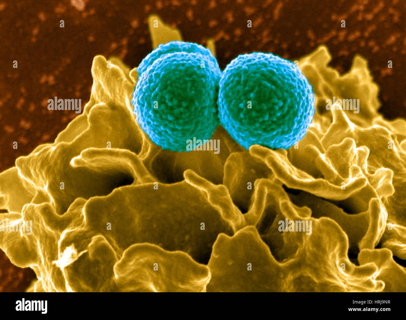 Staphylococcus aureus, le SARM, SEM Photo Stock - Alamy