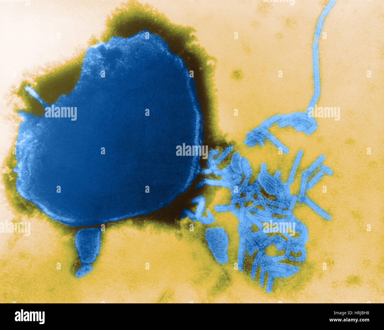 Parotidite infectieuse Banque de photographies et d’images à haute ...