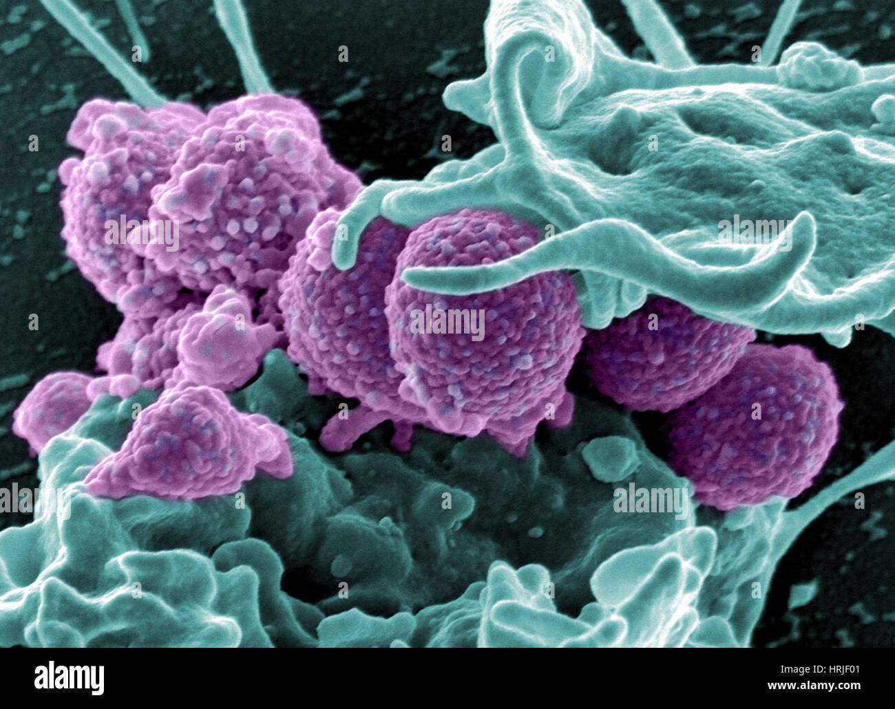 Staphylococcus aureus, le SARM, SEM Photo Stock - Alamy