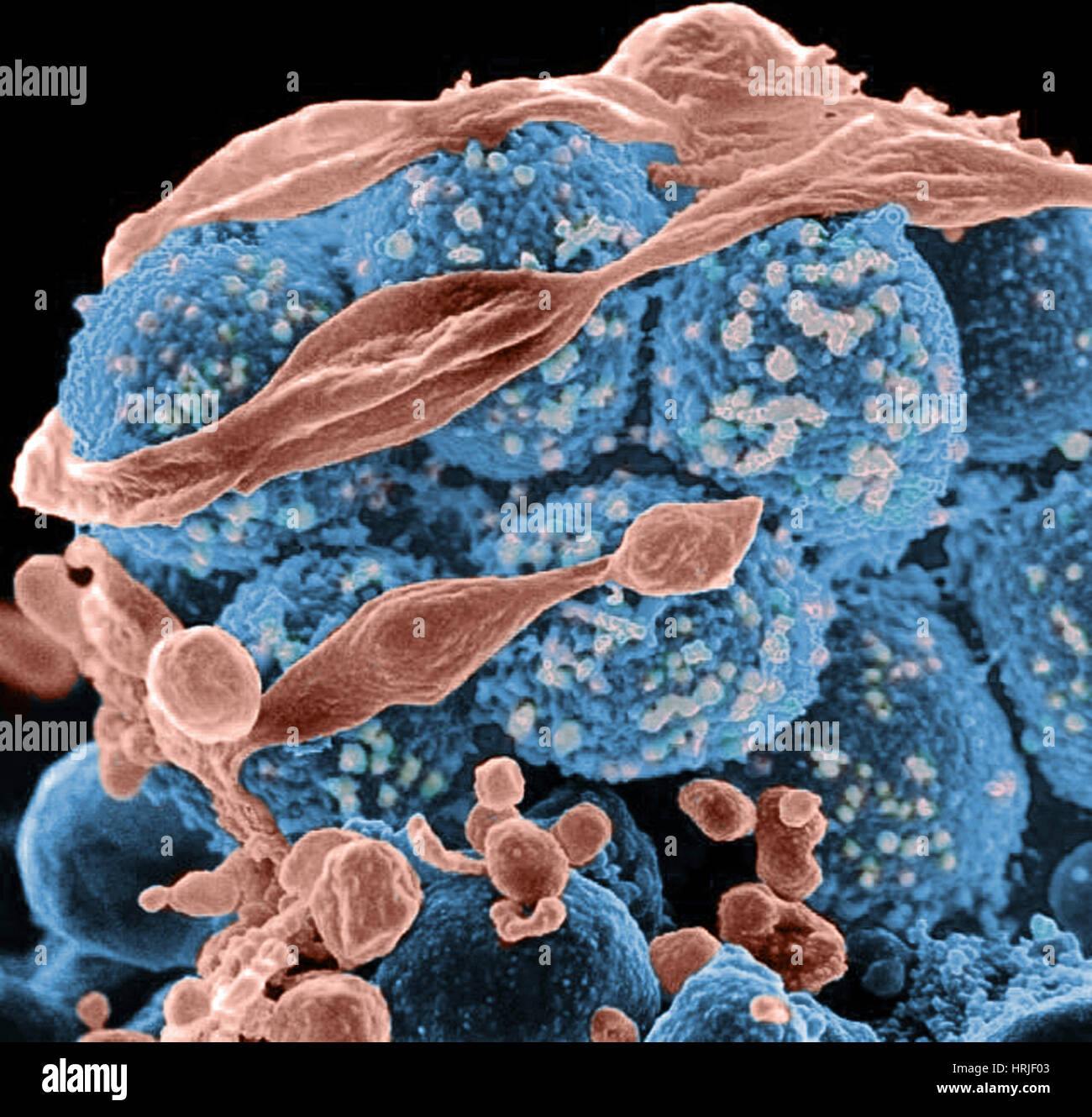 Staphylococcus aureus, le SARM, SEM Photo Stock - Alamy