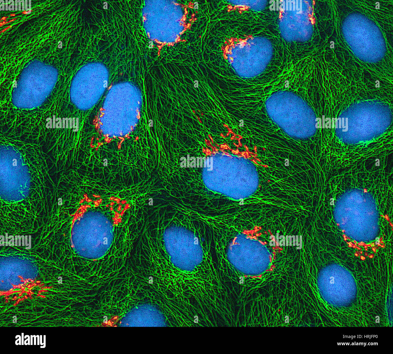 Hela cell Banque de photographies et d’images à haute résolution - Alamy