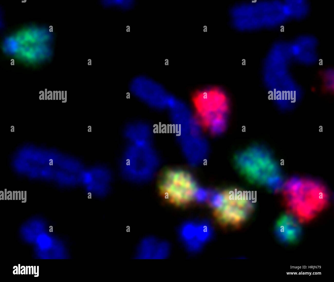 Chromosomes 13 Banque de photographies et d’images à haute résolution ...