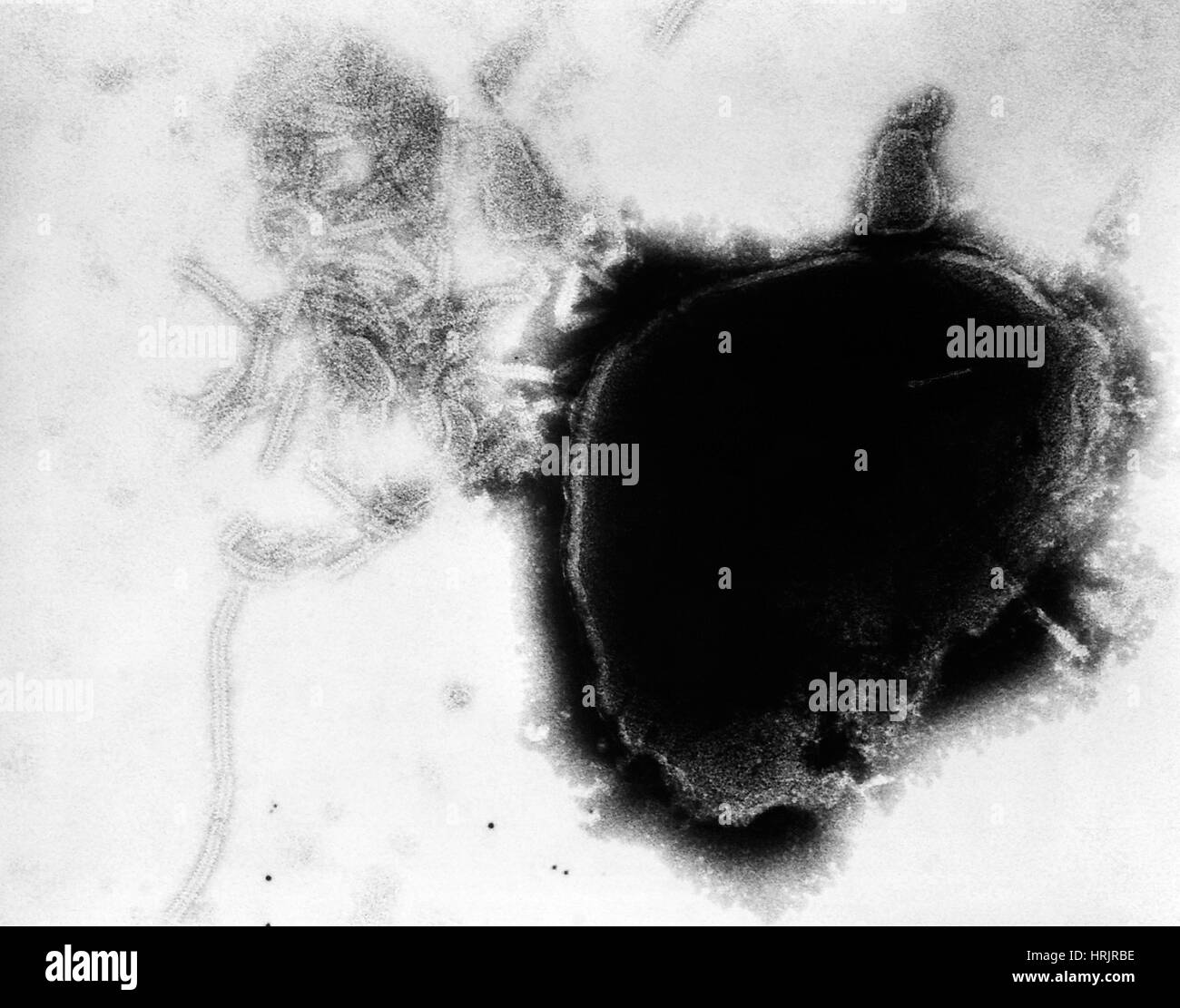 Parotidite des oreillons Banque de photographies et d’images à haute ...