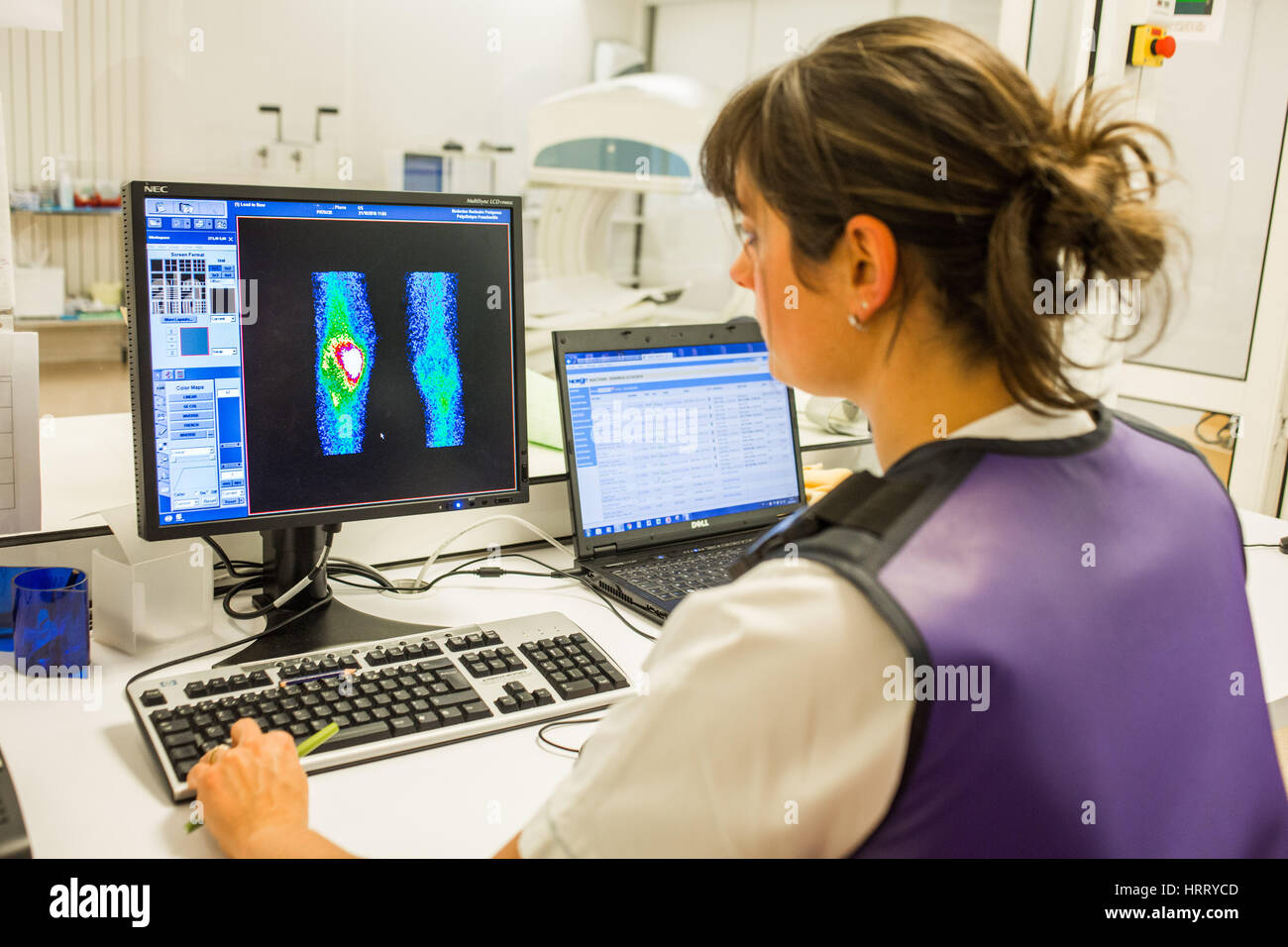 La scintigraphie osseuse, service de médecine nucléaire Photo Stock - Alamy