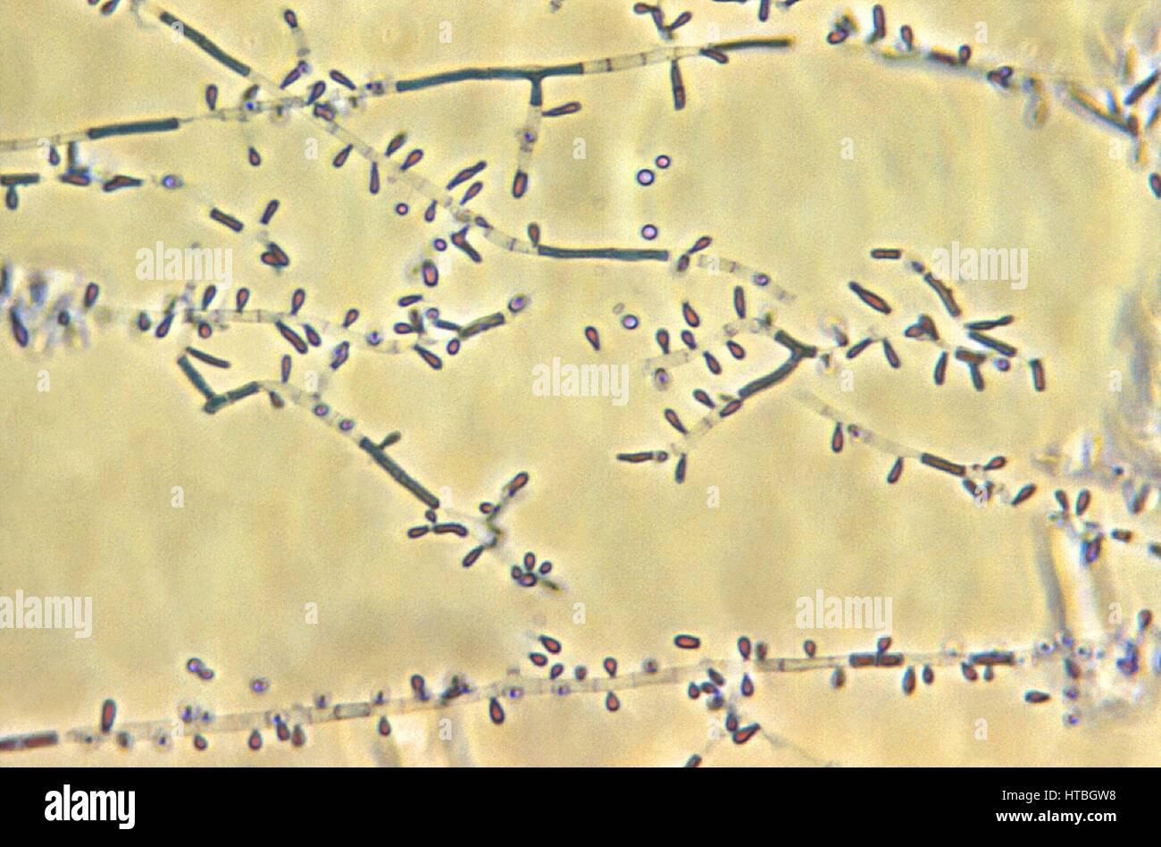 Photomicrographie des microconidies du champignon Trichophyton rubrum ...