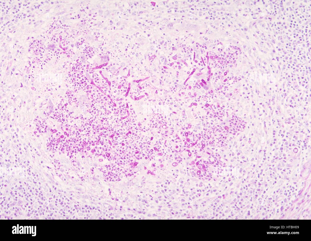 Tissus sous cutanés Banque de photographies et d’images à haute ...