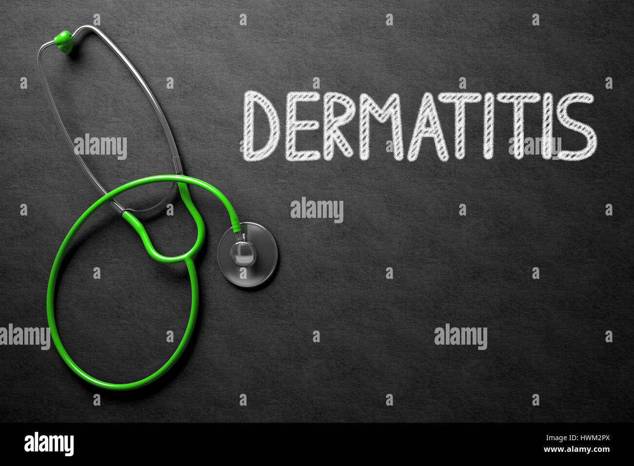 Eczema skin inflammation dermatitis Banque de photographies et d’images ...