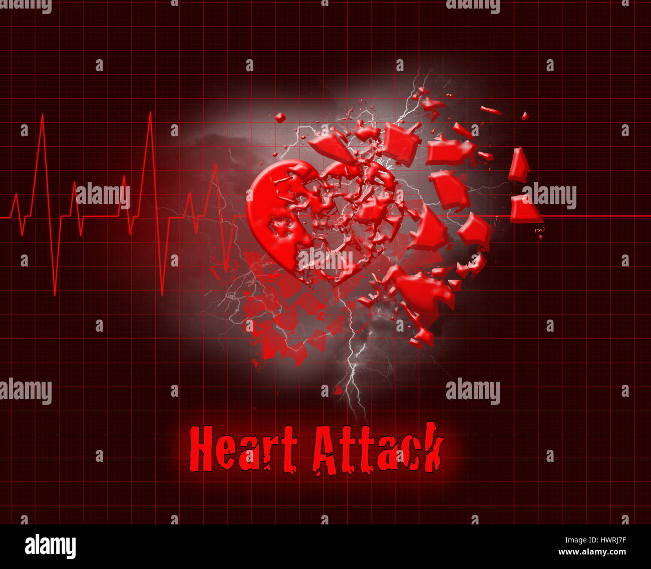 Heart attack patient Banque de photographies et d’images à haute ...