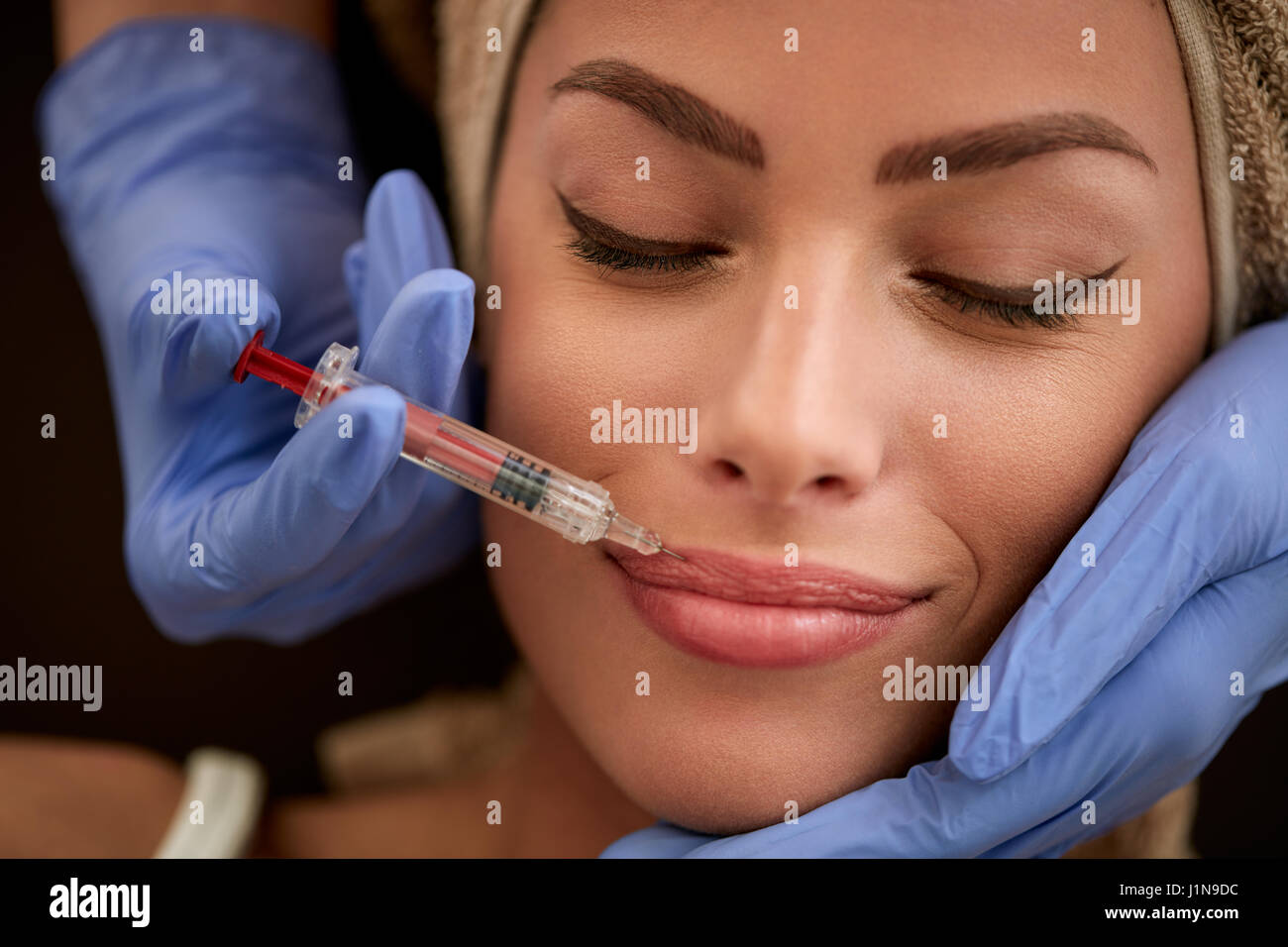 Lèvres botox, traitement de correction de beauté Photo Stock - Alamy