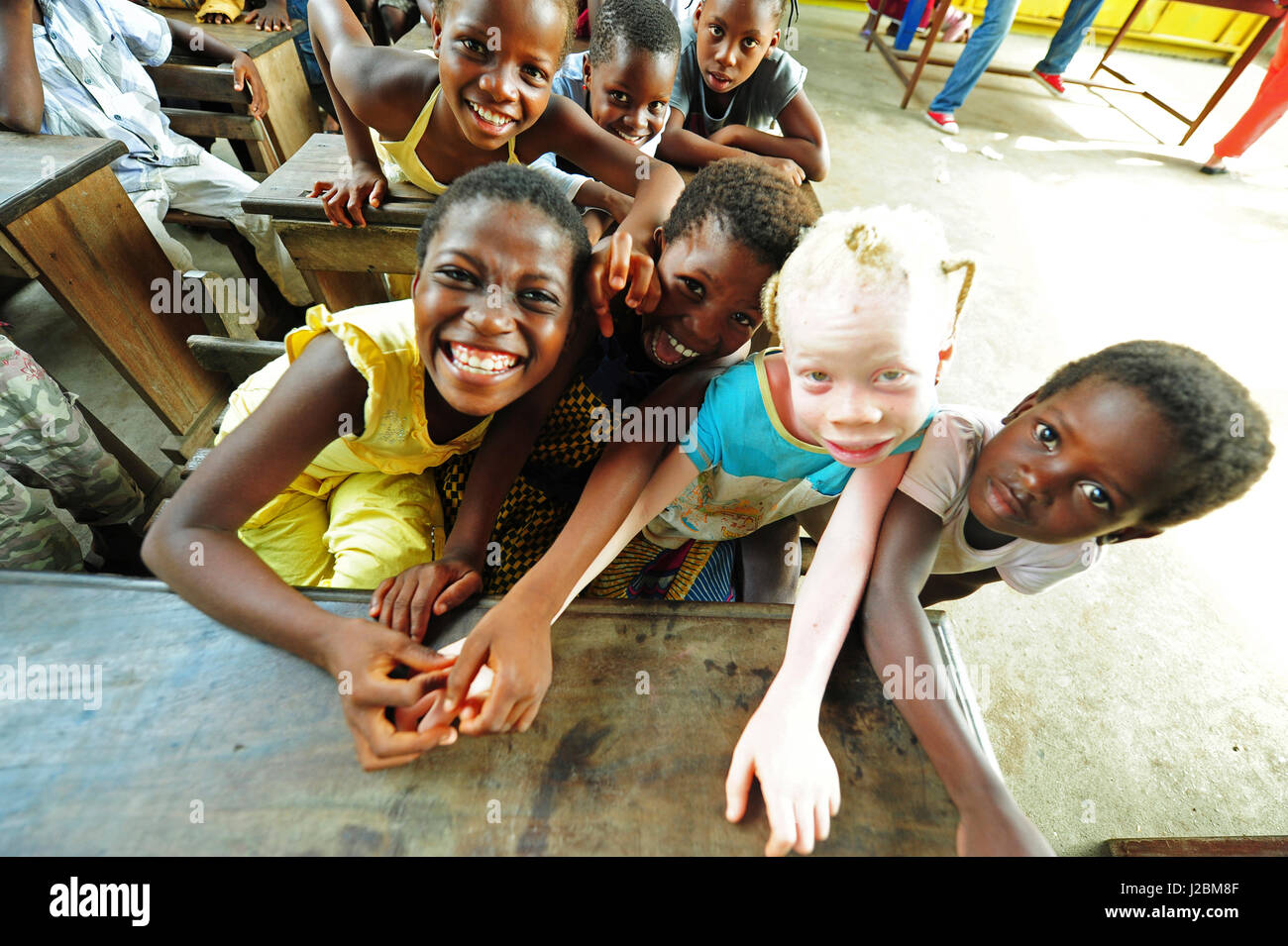 Enfants noirs albinos Banque de photographies et d’images à haute ...