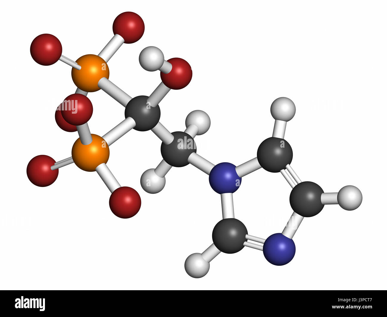 Maladie osseuse paget Banque d'images détourées - Alamy