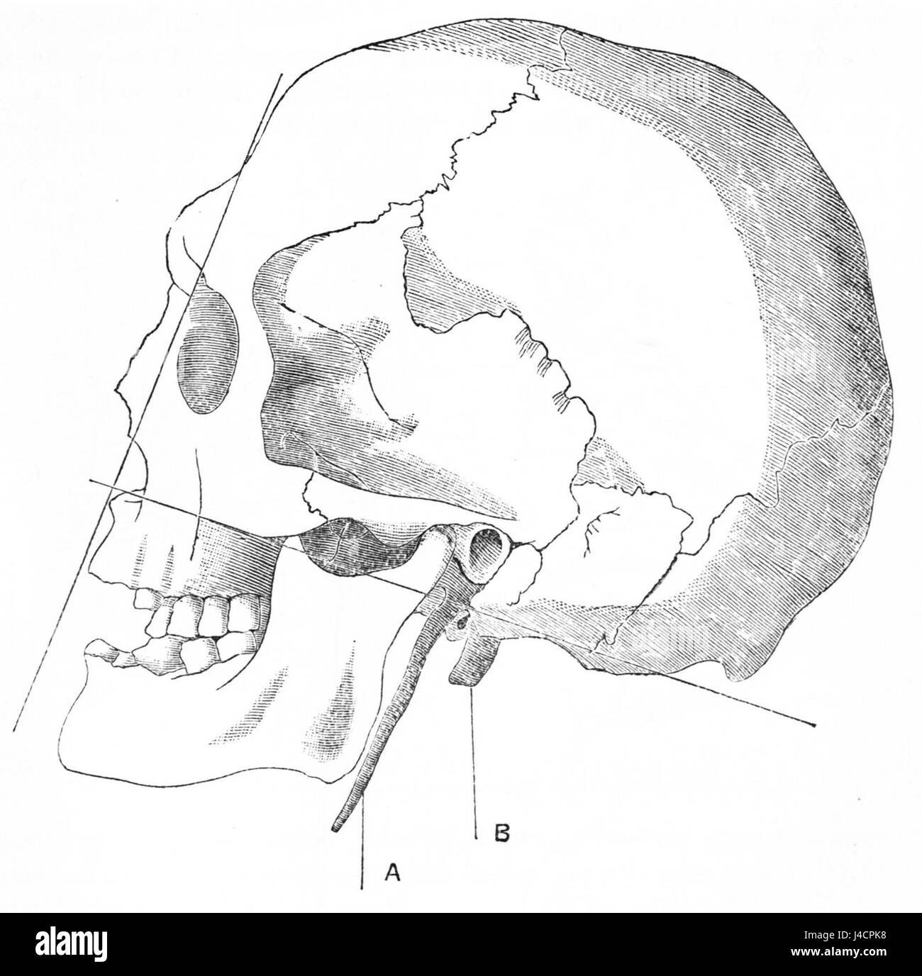 Processus styloïde Banque d'images noir et blanc - Alamy