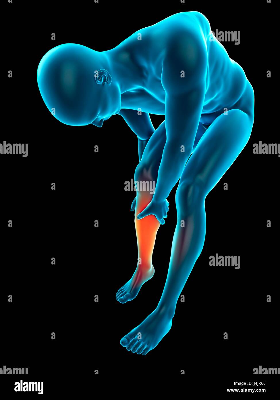 Douleur musculaire au mollet Banque de photographies et d’images à ...