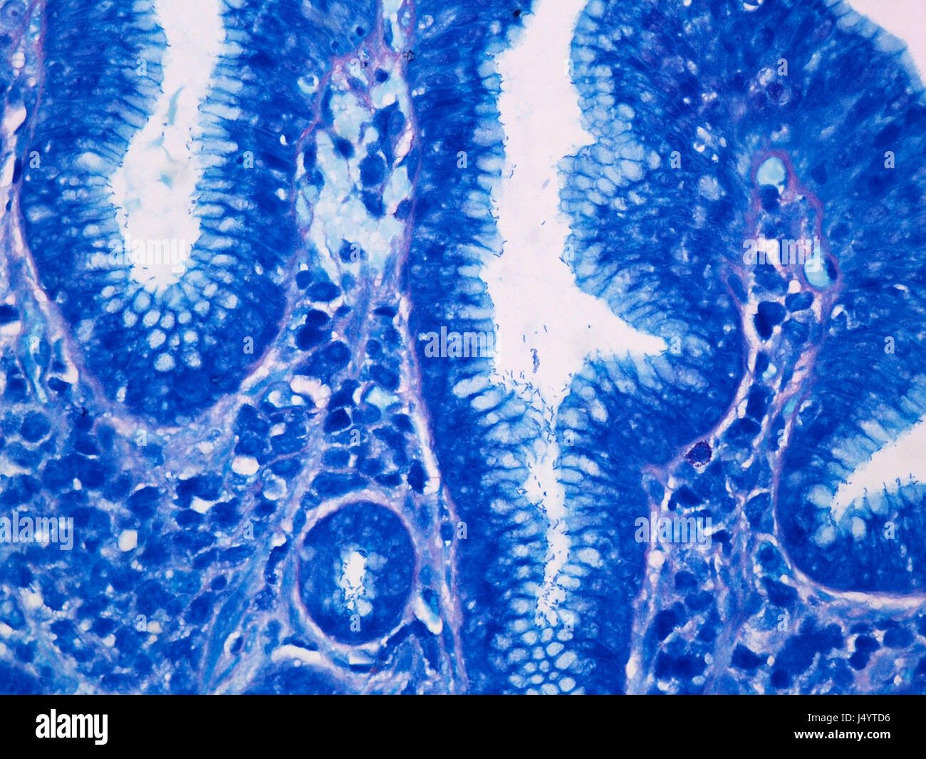 Helicobacter pylori dans l'estomac humain Vue à 400x de grossissement ...