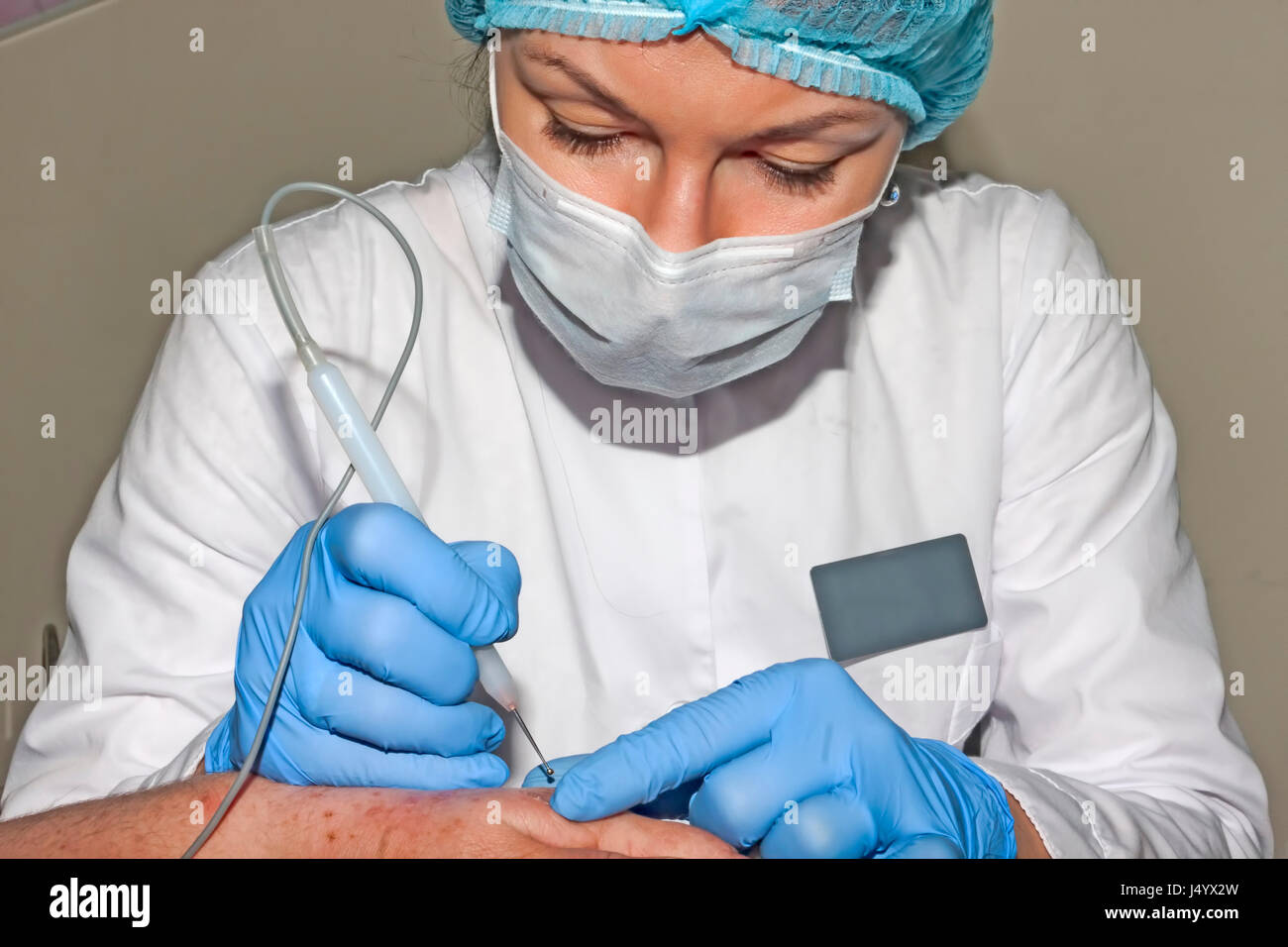 Les maladies de la peau Banque de photographies et d’images à haute ...