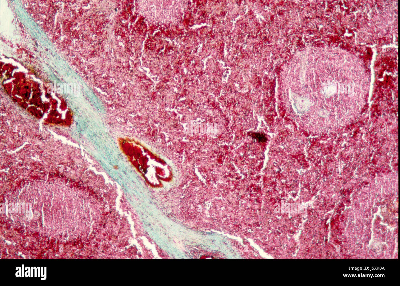 Inneres organ Banque de photographies et d’images à haute résolution ...