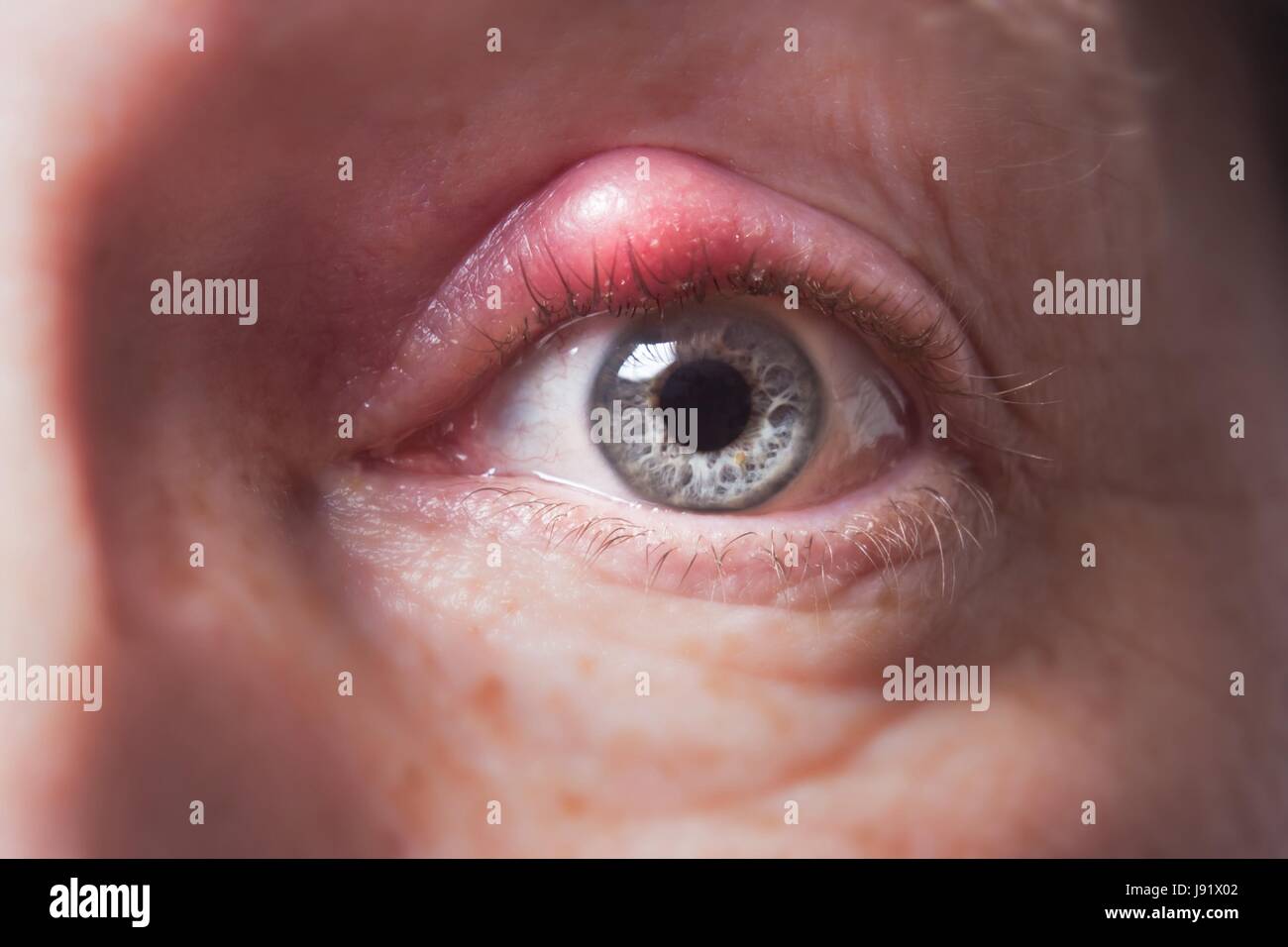 Orgelet pus Banque de photographies et d’images à haute résolution - Alamy