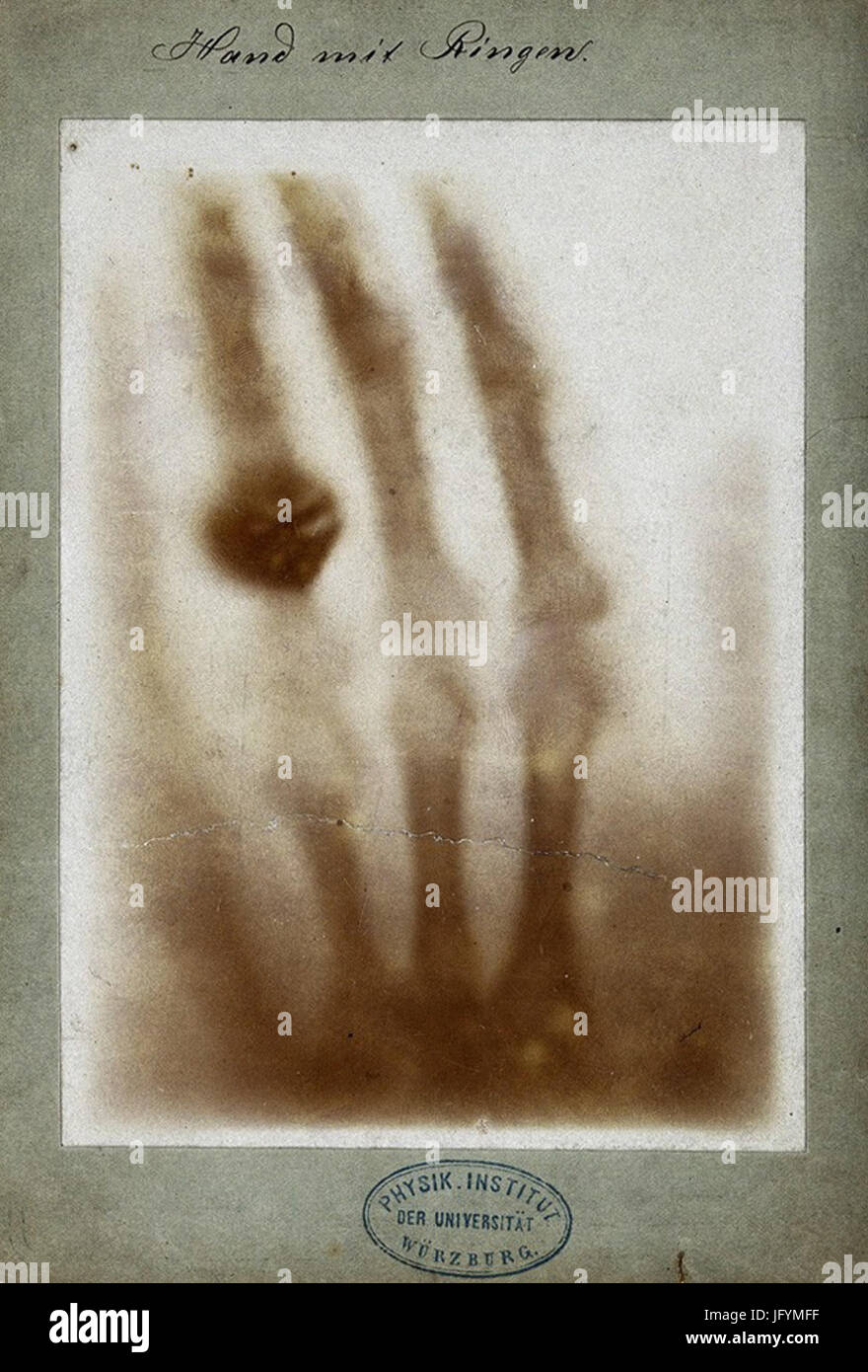 Première radiographie médicale, par Wilhelm Röntgen de sa femme Anna Bertha Ludwig's hand ...