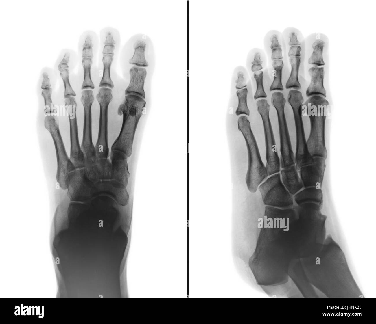 Anatomie normale du corps humain Banque d'images noir et blanc - Alamy