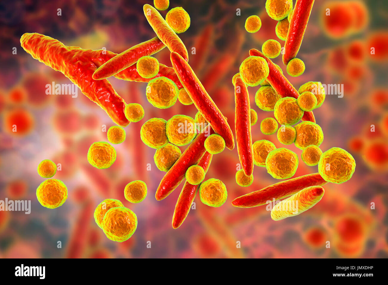 Maladie de la muqueuse Banque de photographies et d’images à haute ...