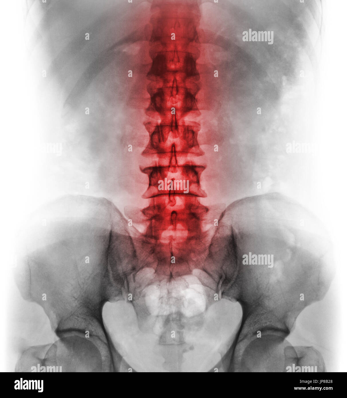 Bassin saine radiographie Banque de photographies et d’images à haute ...