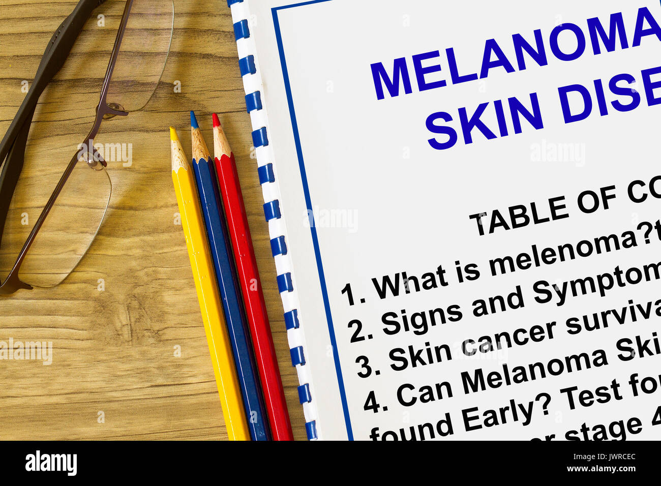 Mélanome cancer de la peau Banque de photographies et d’images à haute résolution - Alamy