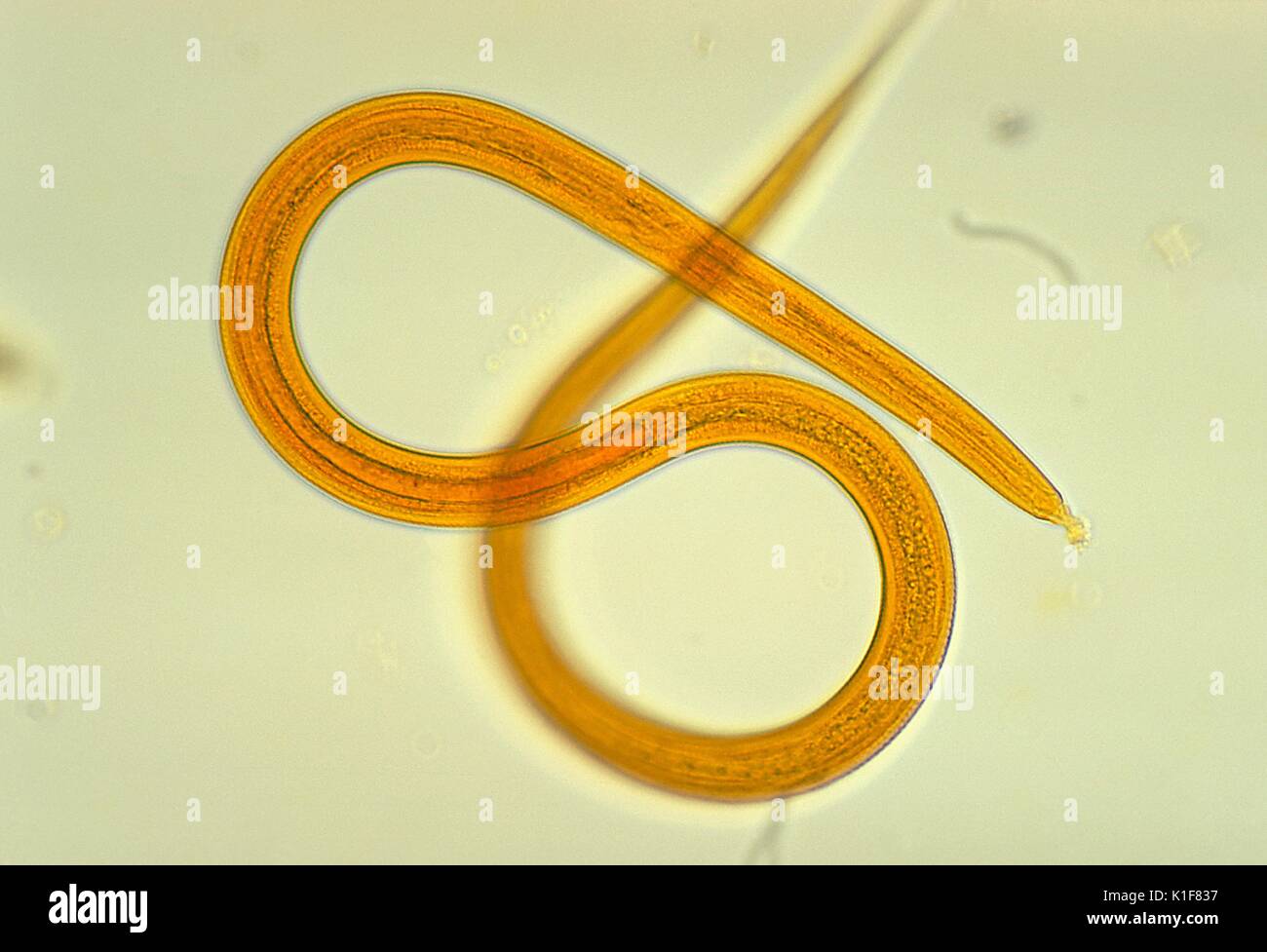 Strongyloides stercoralis Banque de photographies et d’images à haute ...