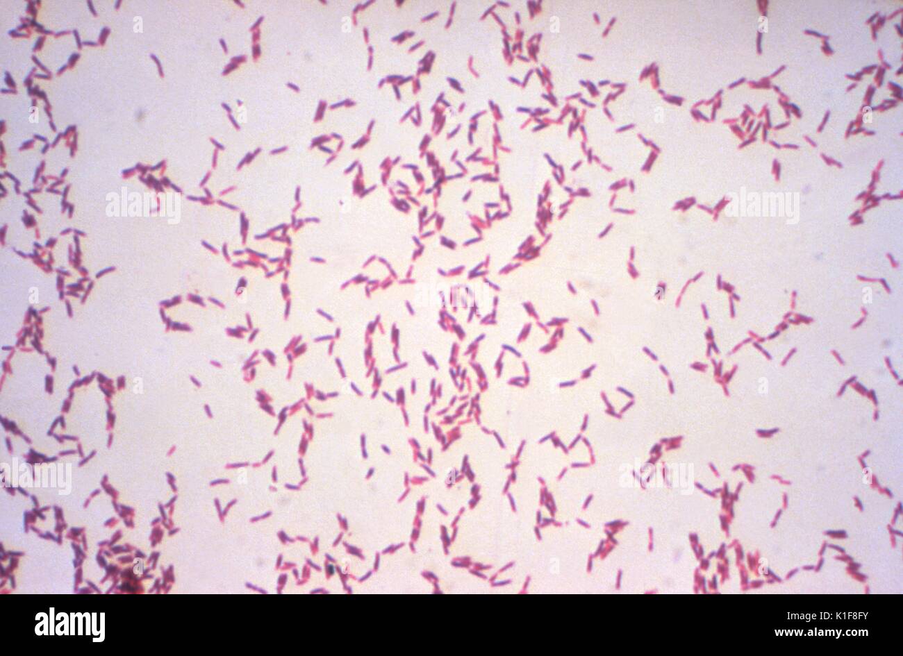 Actinomyces viscosus . Une coloration de Gram. Image courtoisie CDC/Dr ...
