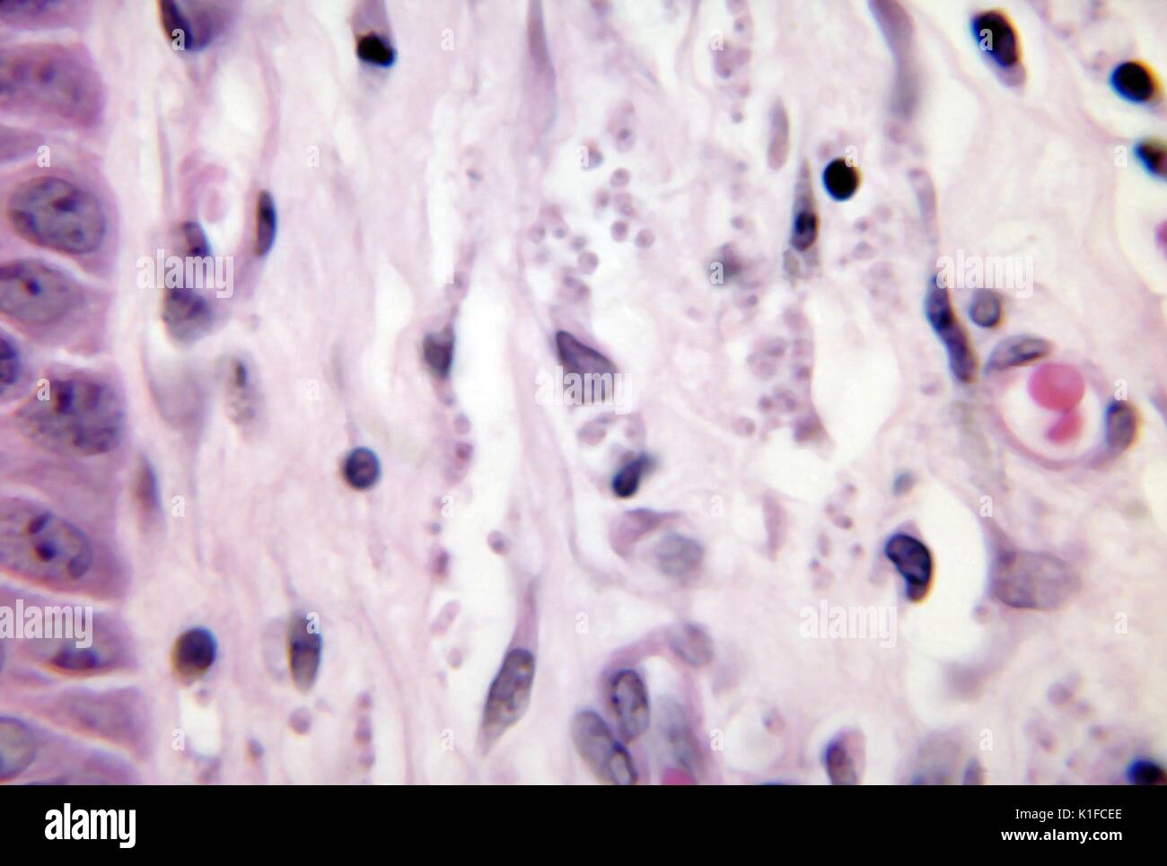 Leishmania parasites Banque de photographies et d’images à haute ...