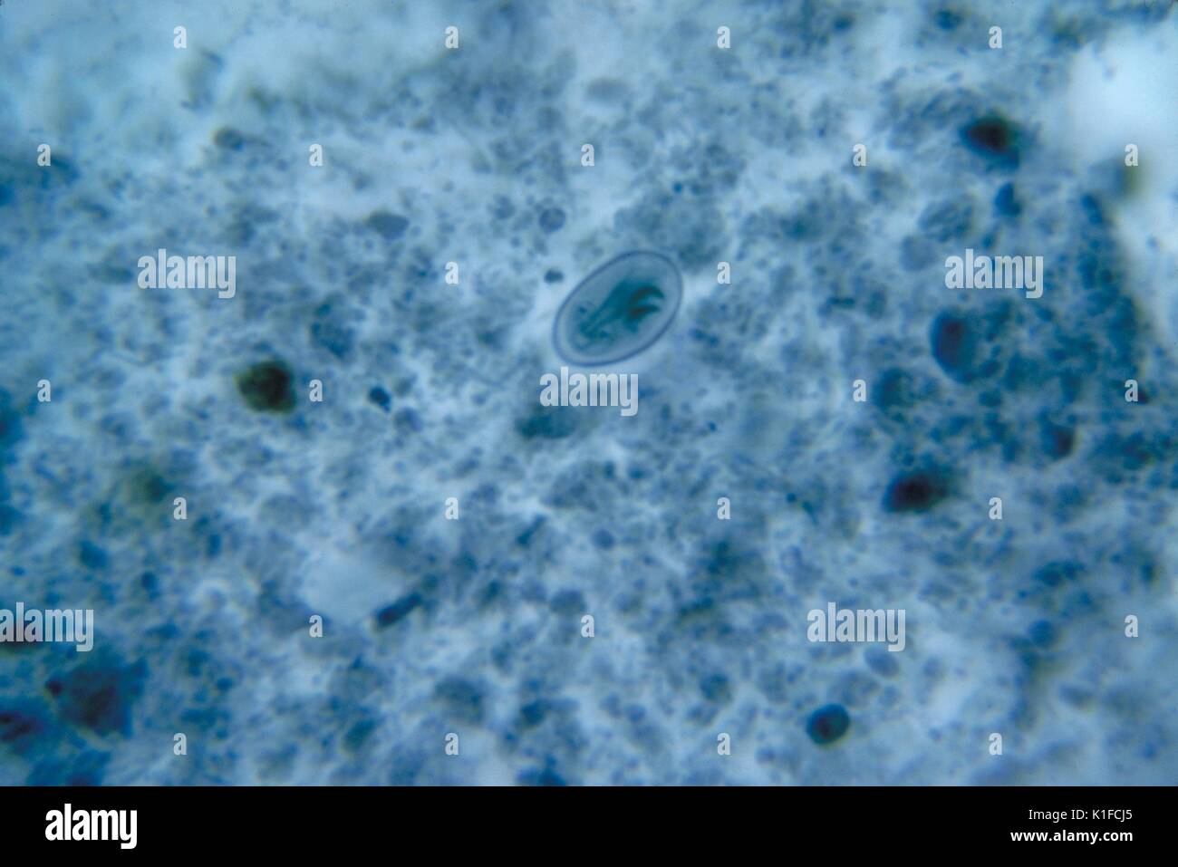 Giardia lamblia cyst Banque de photographies et d’images à haute ...