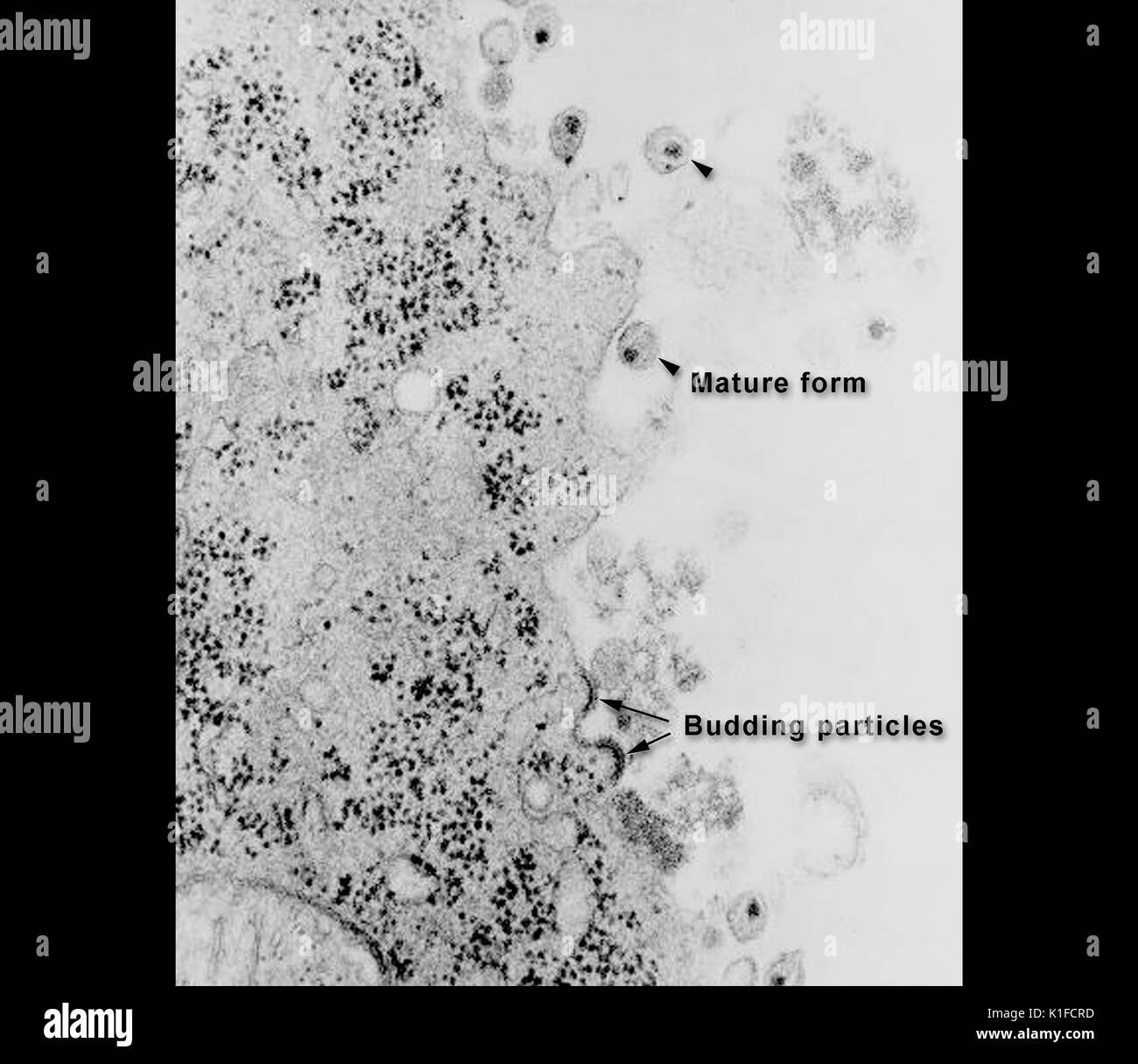 Transmission du vih Banque d'images noir et blanc - Alamy