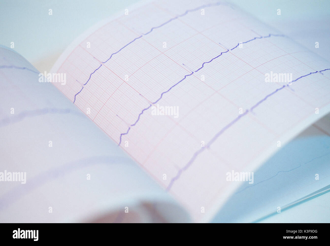 Stress ecg Banque de photographies et d’images à haute résolution - Alamy