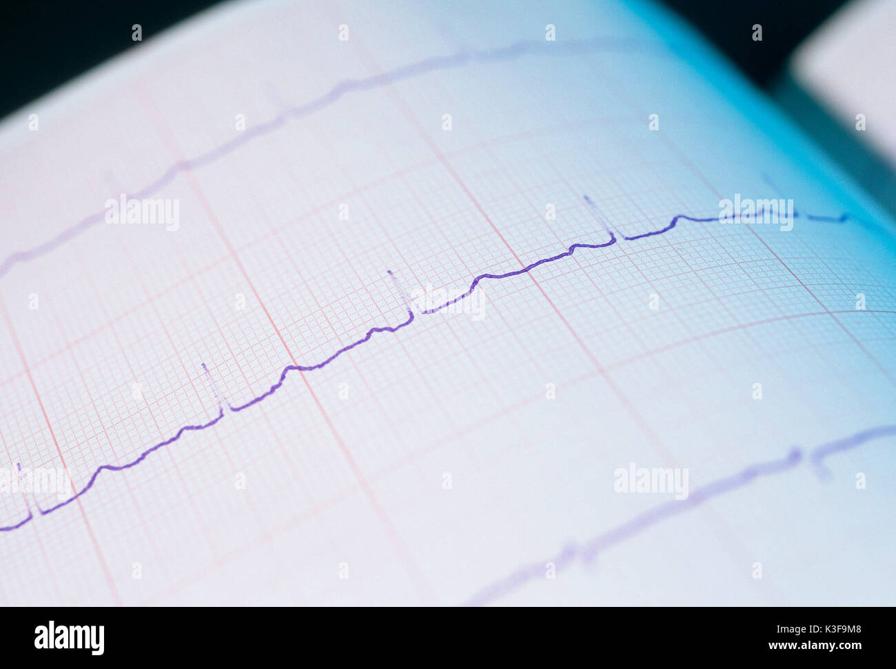 Prueba de ecg Banque de photographies et d’images à haute résolution ...