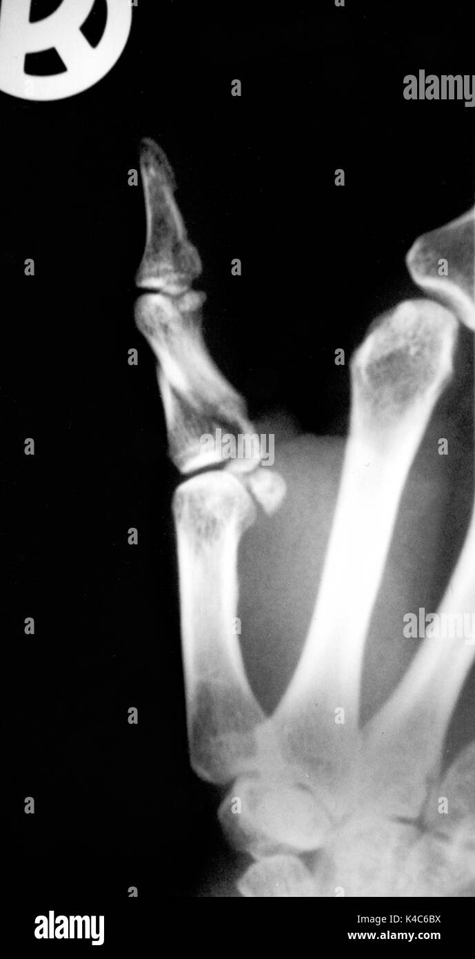 Radiographie d Banque de photographies et d’images à haute résolution ...