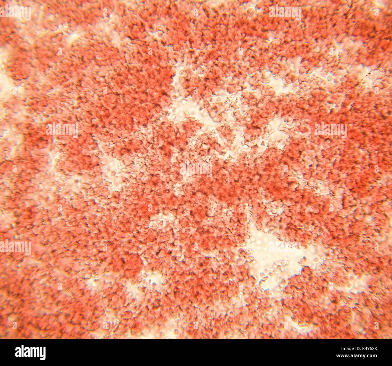 Frottis sanguin sous microscope présente des neutrophiles et globules ...