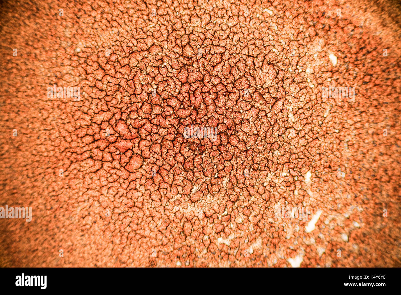 Sang coagulé solidifié vu sur un 100x microscope vue. frottis sanguin ...